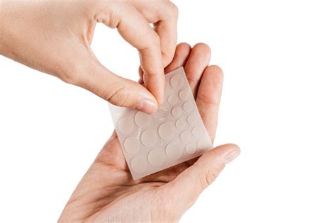 여드름과 주사비 클로즈업 치료를위한 여드름 패치 얼굴 회춘 클렌징 화장품 흰색 배경에 손에 여드름에 대 한 둥근 패치 세트입니다 건강관리와 의술에 대한 스톡 사진 및 기타