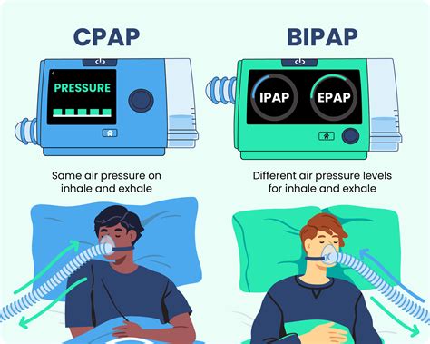 Difference Between Cpap And Bipap Machine At Elaine Boehme Blog