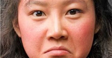 미쓰 홍당무 안면 홍조 탈출법