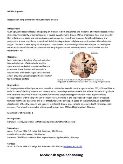 041 Detection Of Early Biomarkers For Alzheimers Disease Pdf