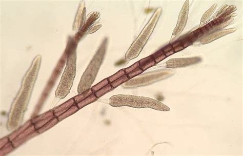 Polysiphonia Under Microscope