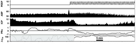 comparing pressure reactivity index prx arbitrary units induced prx