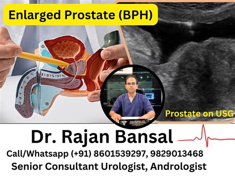 What Is Serum Creatinine