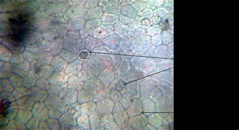 C Epidermal Tissue Of C Aconitifolius Leaf Showing Anomocytic Stomata