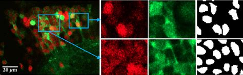 Neuron Segmentation Using Deep Complete Bipartite Networks Paper And Code