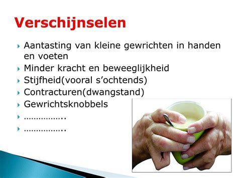 Ppt Reuma Powerpoint Presentation Free Download Id4052008