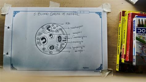 Labeled Blood Smear Drawing At Amber Mcleod Blog