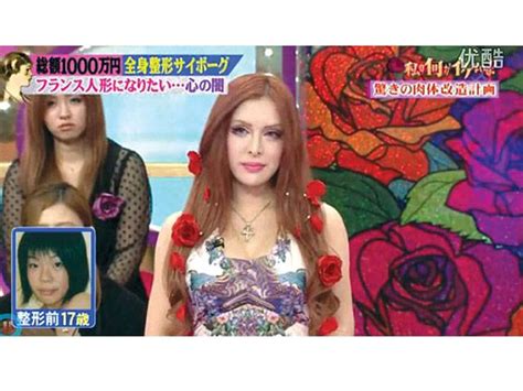 Model Spends 100k On Surgery To Look Like Doll