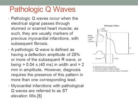 Image Result For Pathologic Q Wave Ecg Waves School Hacks Heart Muscle