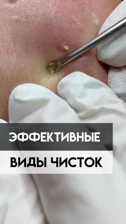 Эффективно и правильно очистить кожу лица Youtube