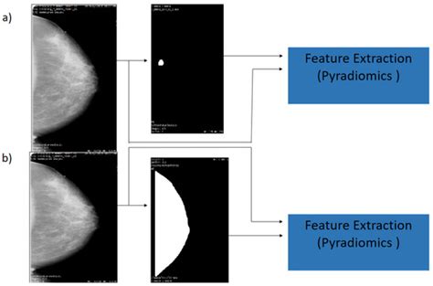 Breast Cancer Detection Using Automated Segmentation And Genetic Algorithms