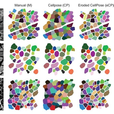 Benchmarking Of Cellpose Algorithm Across Different Image Sizes And