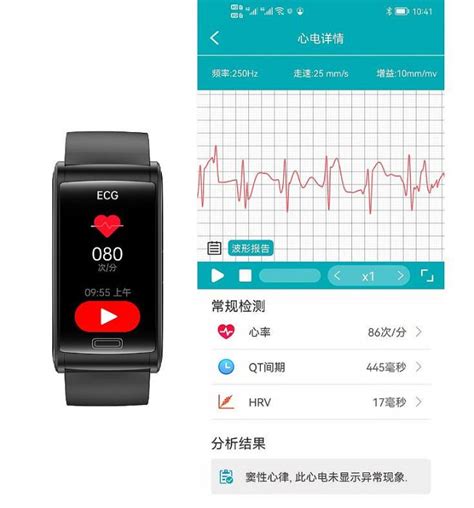小米優選 智能手錶 智慧手錶 Ecg心電圖 血糖手錶 繁體中文 無創血糖監測 血壓手錶 運動手錶 測心率手錶 訊息提示 Yahoo奇摩拍賣