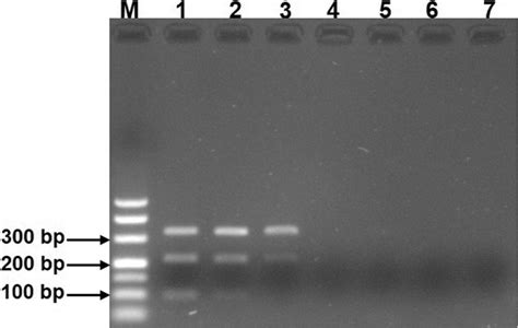 Sensitivity Detection Of Mpcr M Dl 500 Dna Marker L1 − 6 The Download Scientific Diagram