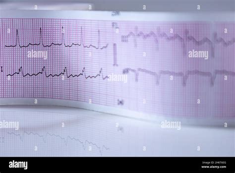 Electrocardiogram Graph Ekg Heart Rhythm Hi Res Stock Photography And Images Alamy
