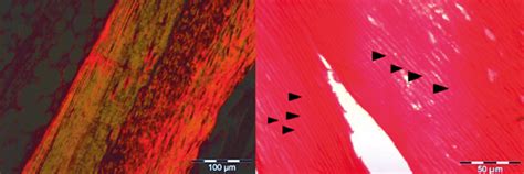 Collagen Fi Brils On The Primary Bone Svl 8432 Mm Stain