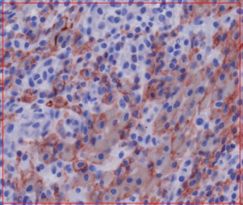 Positive Cell Detection False Positives Image Analysis Imagesc Forum