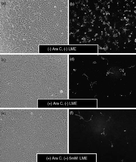 Treatment With 5 Mm Lme 8 H Does Not Eradicate Microglia From Download Scientific Diagram
