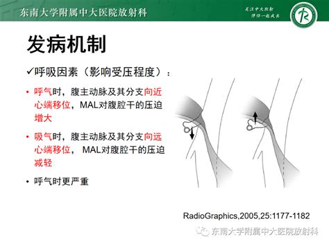 正中弓状韧带压迫综合征 MALS 放射科