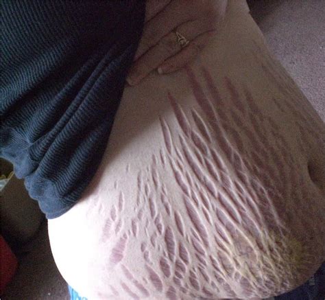 Before And After Pregnant Belly Funnymadworld