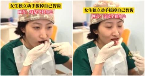 勇敢一點！女牙醫自己拔智齒 驚人影片曝光 生活 Ctwant
