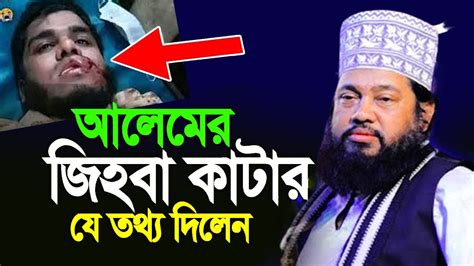 অবশেষে বক্তার জিহ্বা কেটে নেয়ার আসল ঘটনা বের হলো । তারেক মনোয়ার