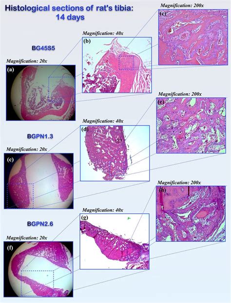 Micrographs Of Transversal Histological Sections Of Rat Tibia Tissues
