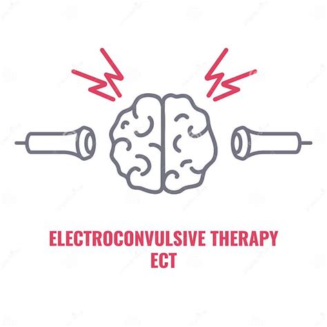 Ect Electroconvulsive Therapy For Severe Depression Treatment Stock