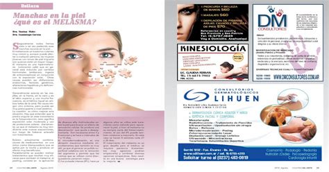 Manchas En La Piel ¿qué Es El Melasma · Manchas Oscuras En La Piel El