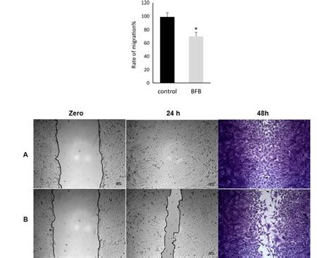 The Wound Healing Assay In Mcf 7 Cells A Untreated Cells B Cells