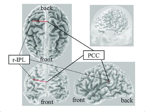 Result Of Eloreta For The Comparison Of Functional Connectivity In Download Scientific