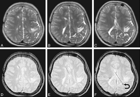 Figure 1 From Mr Imaging Protocol In Nonsedated Recalled Echo Sequences