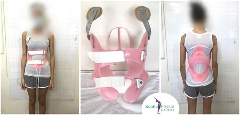 Kyphosis Brace