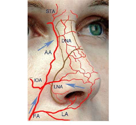 Lateral Nasal Artery