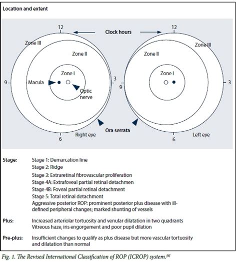 Screening For Retinopathy Of Prematurity In A Provincial Hospital In