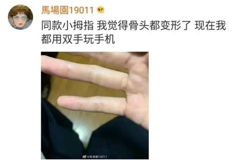 玩手机导致小拇指变形，还有救吗？南方plus南方