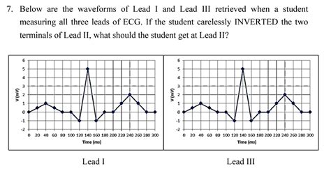 Solved 7 Below Are The Waveforms Of Lead I And Lead Iii