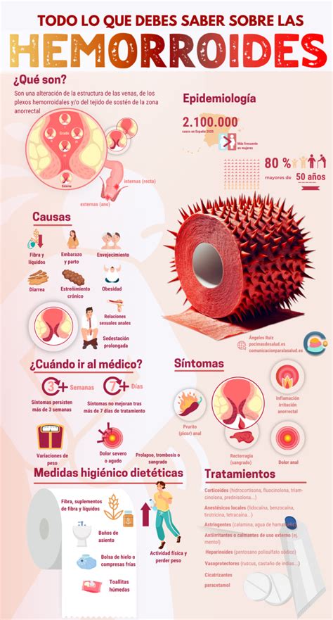 Hemorroides Externas Son Peligrosas