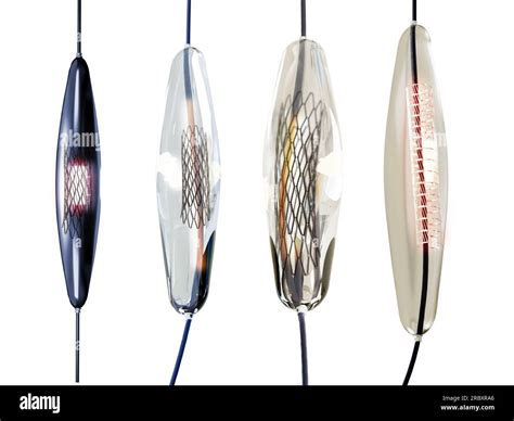 Mesh Metal Nitinol Self Expandable Stent 3d Rendering For Endovascular