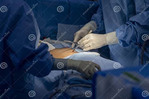 People Did Sensory Testing After General Anesthesia In Patient Undergo Abdominal Surgeryspinal