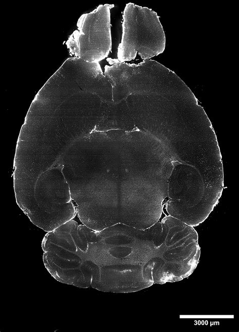 Mouse Brain Goat Olig2 Lifecanvas Technologies