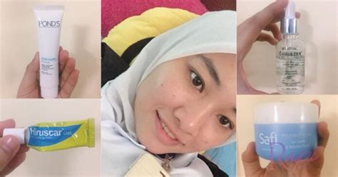 Kulit Breakout Teruk Wanita Ini Kongsi Barang Baik Yang Pulihkan Wajah