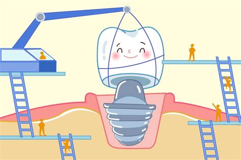 Why Replacing Lost Teeth Is Important Santa Ana Ca Sunset Dental Group
