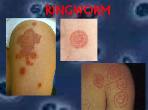 Types Of Pathogen Mapeh 8 Health Ppt