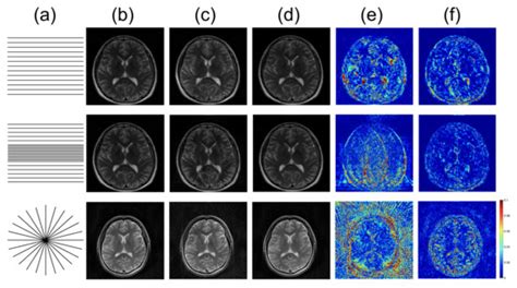 Sensors Free Full Text An End To End Recurrent Neural Network For