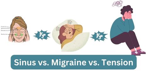 Sinus Vs Migraine Vs Tension Headaches Decoding Of The Ache