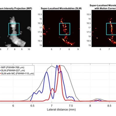 Pdf Ultrasound Super Resolution With Microbubble Contrast Agents