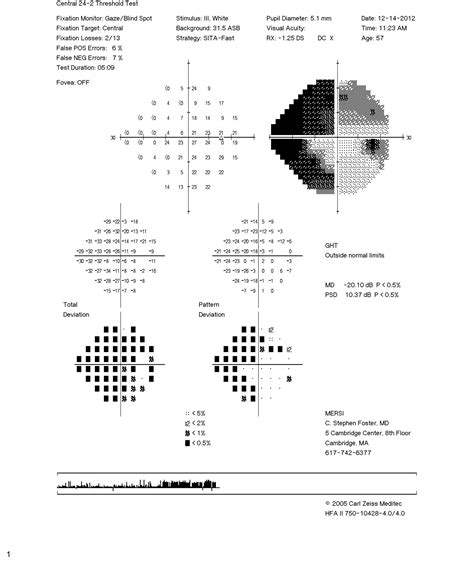 Visual Field Test St Augustine Trinidad West Indies Precision Cataract