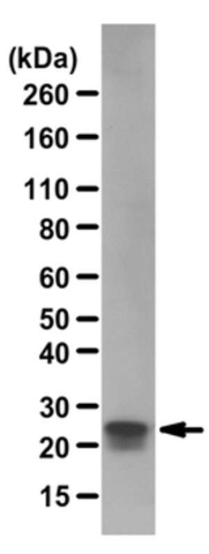 Anti Phospho Rac1cdc42 Ser71 Antibody From Rabbit Purified By