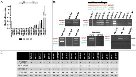 Hpv16 E6 And E7 Transcript Expression A Top Qrt Pcr Primer Design Download Scientific
